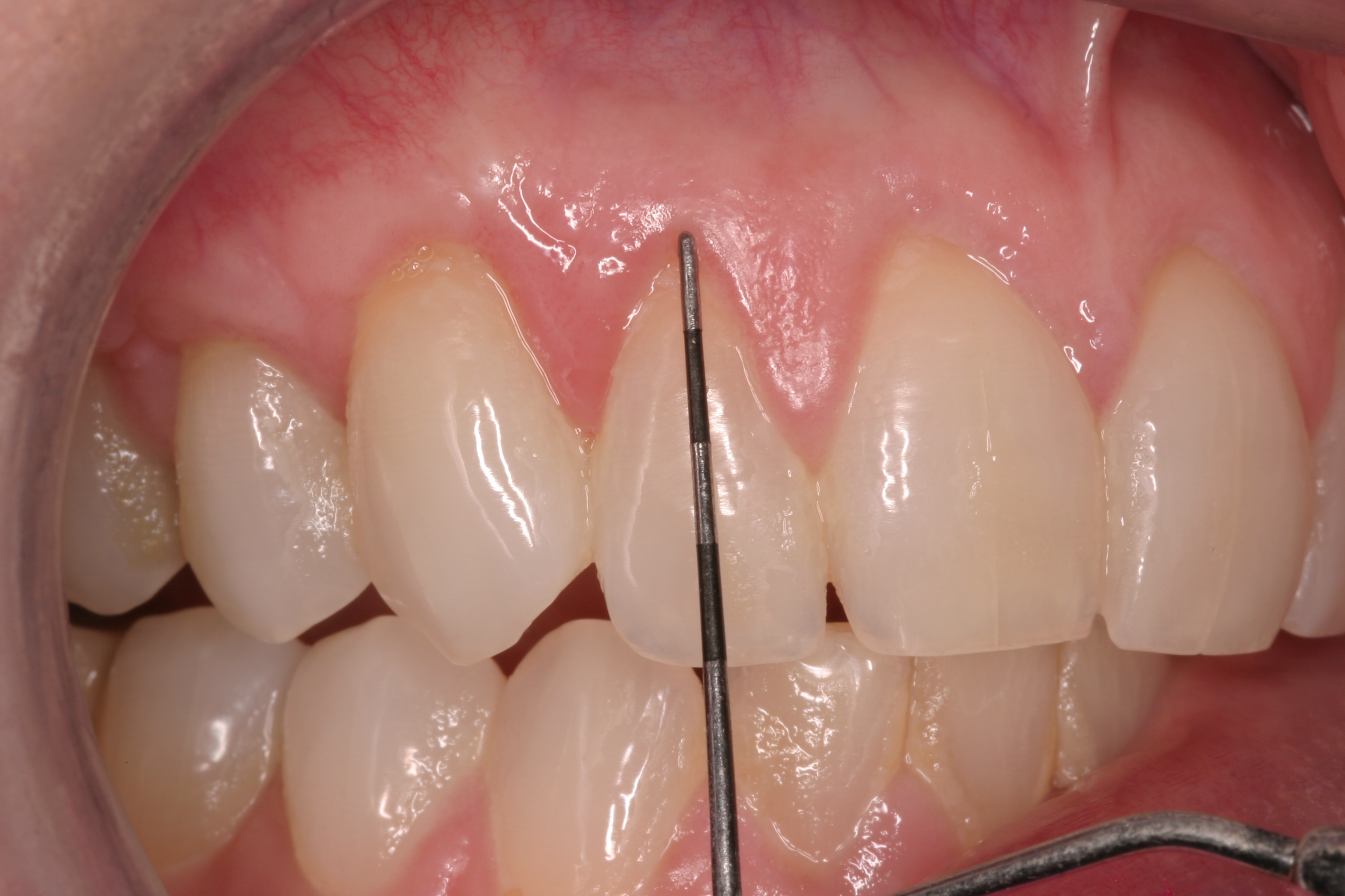 Periodontal Concepts for The Modern Dental Practice: From Diagnosis to ...